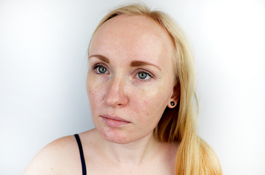 8 Simple Ways to Improve Congested Skin and Clogged Pores — Graydon ...