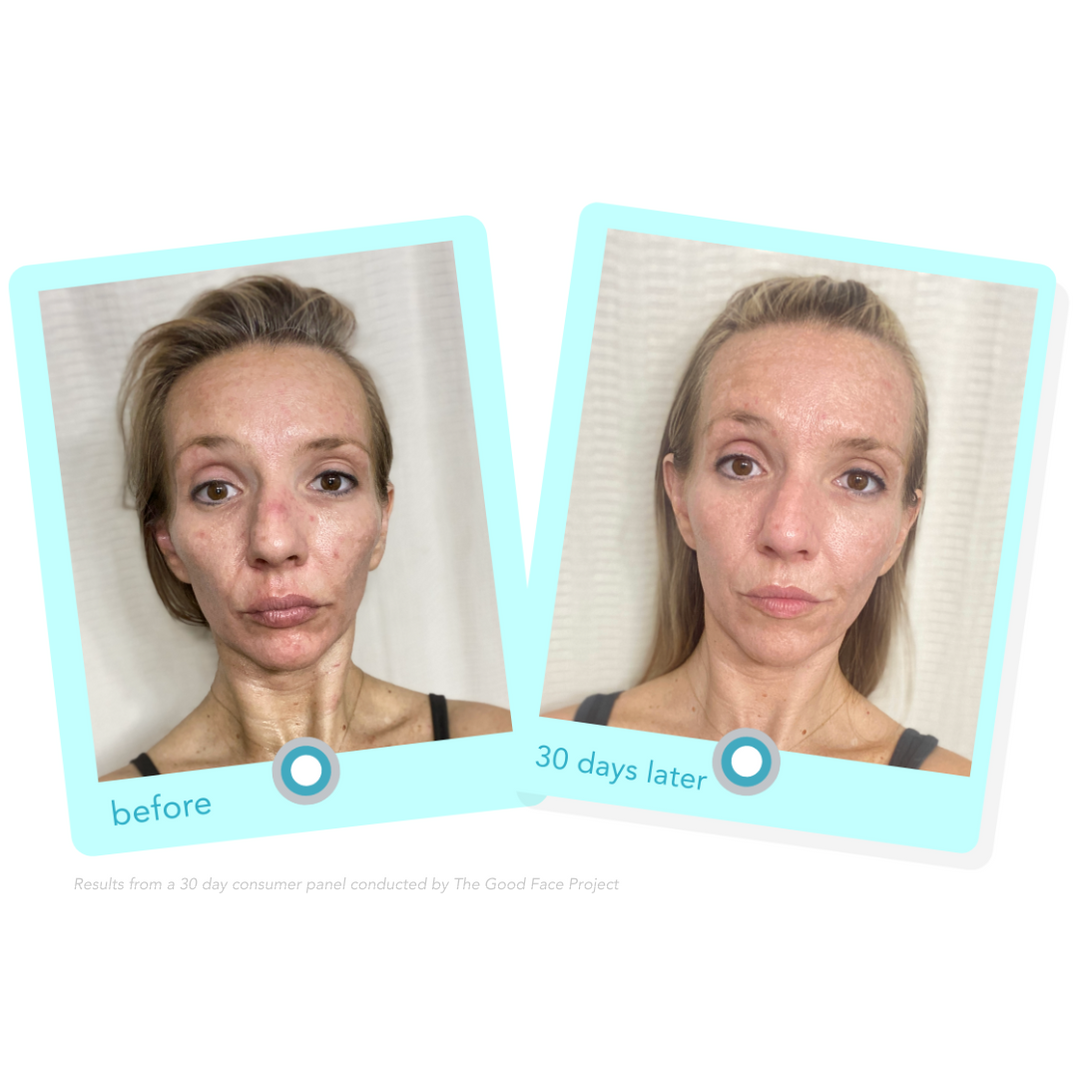 8 Simple Ways to Improve Congested Skin and Clogged Pores — Graydon ...